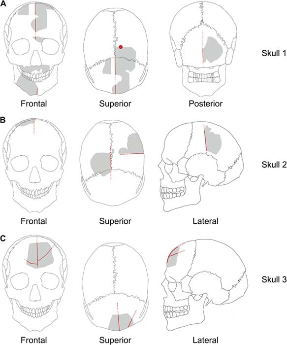 Evidence of the Earliest ‘Skull Cult’ Activity: Drilled and Carved ...