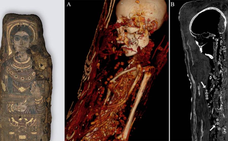portrait mummies | Ancient Origins