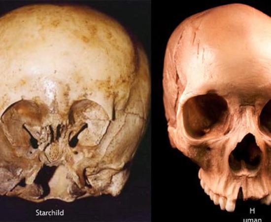 starchild   starchild