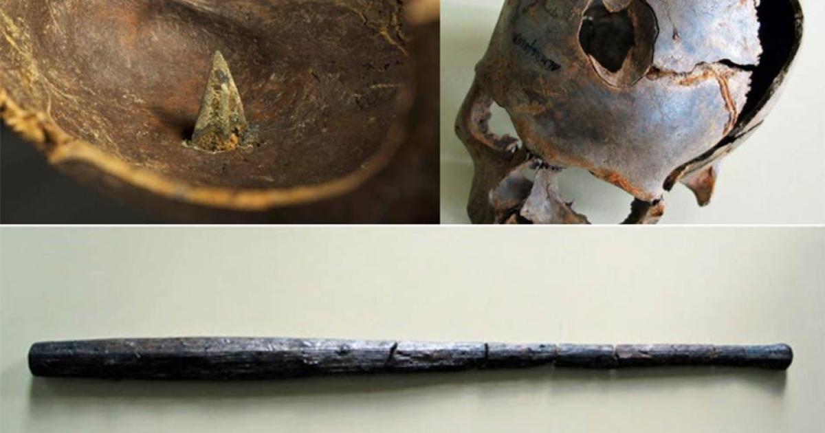 Archaeologists Discover Tollense Battle Was Actually A Massacre ...