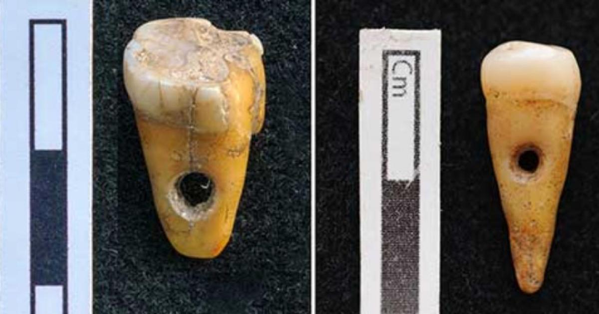 8,500-Year-Old Human Teeth Jewelry Unearthed in Turkey | Ancient Origins