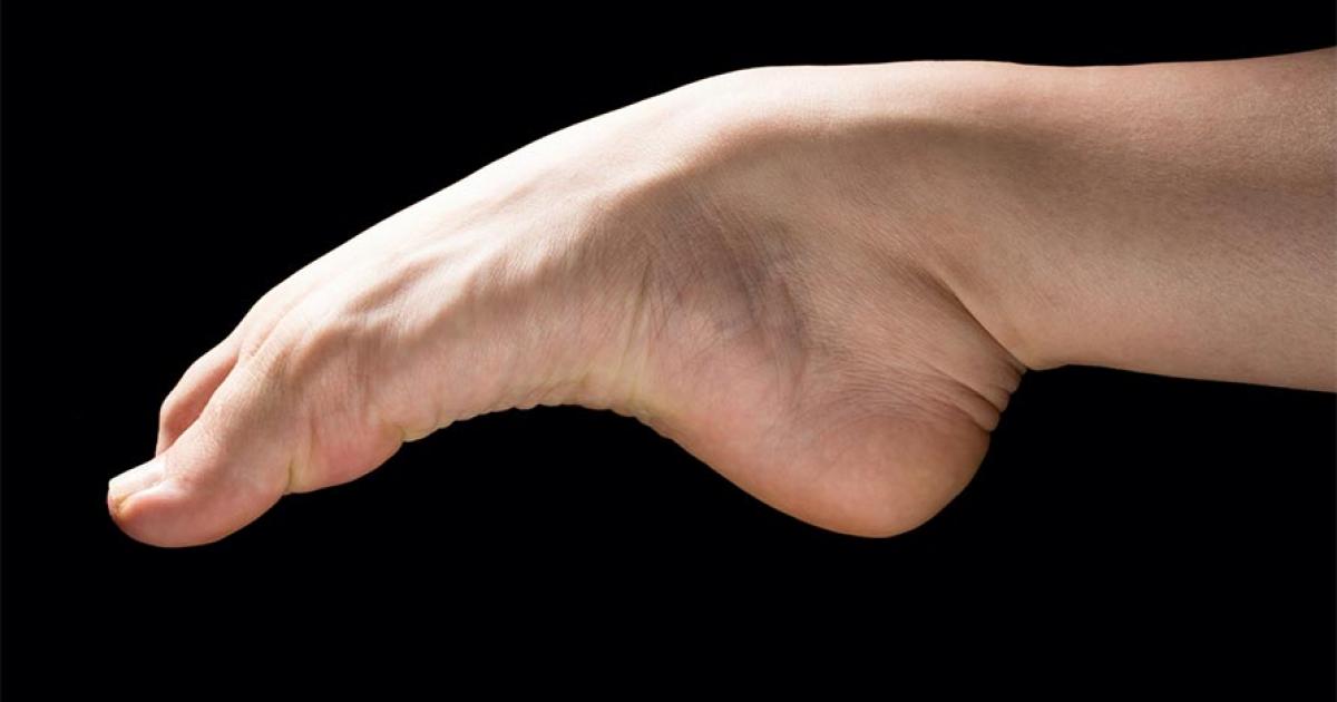 Scientists Study 3.5-Million-Year-Old Origins of Unique Human Spring ...