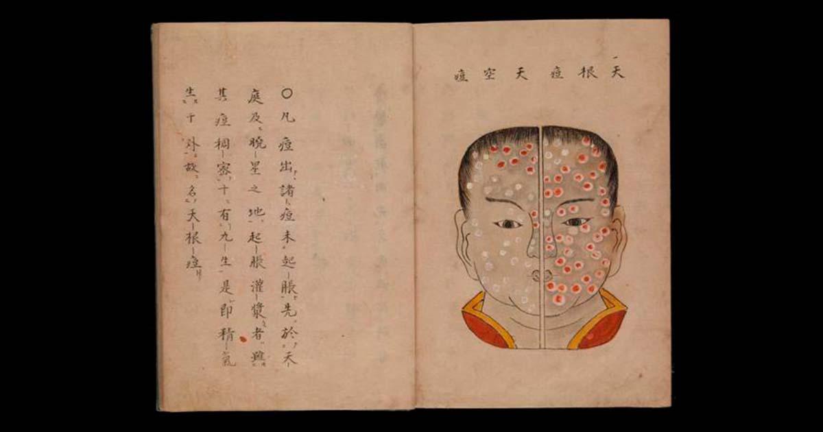 The Japanese Smallpox Epidemic of the 8th Century: Cause and Effect ...