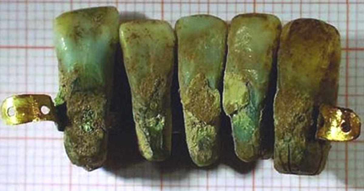Archaeologists Find Medieval Dentures Made from the Teeth of Dead ...