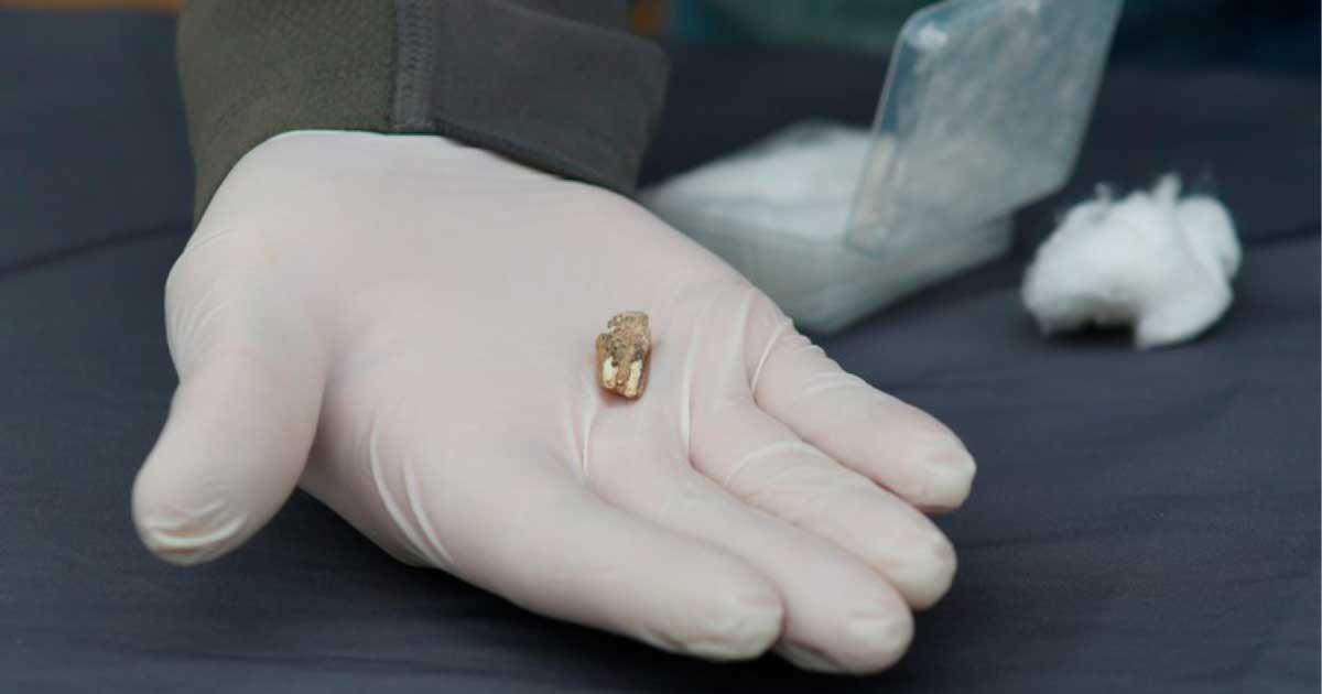 Early Humans Out of Africa: 1.8 Myo Tooth Found in Orozmani, Georgia ...
