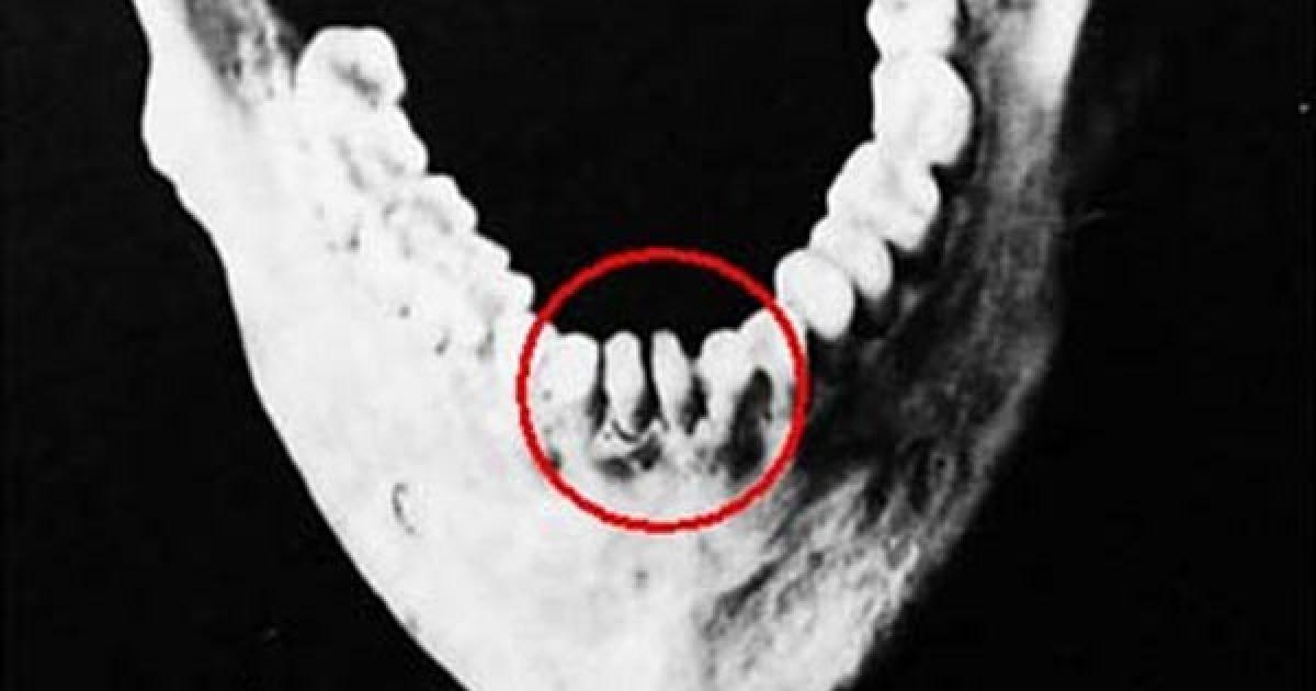 Archaeologists announce Qiang people had vertically oriented teeth and ...