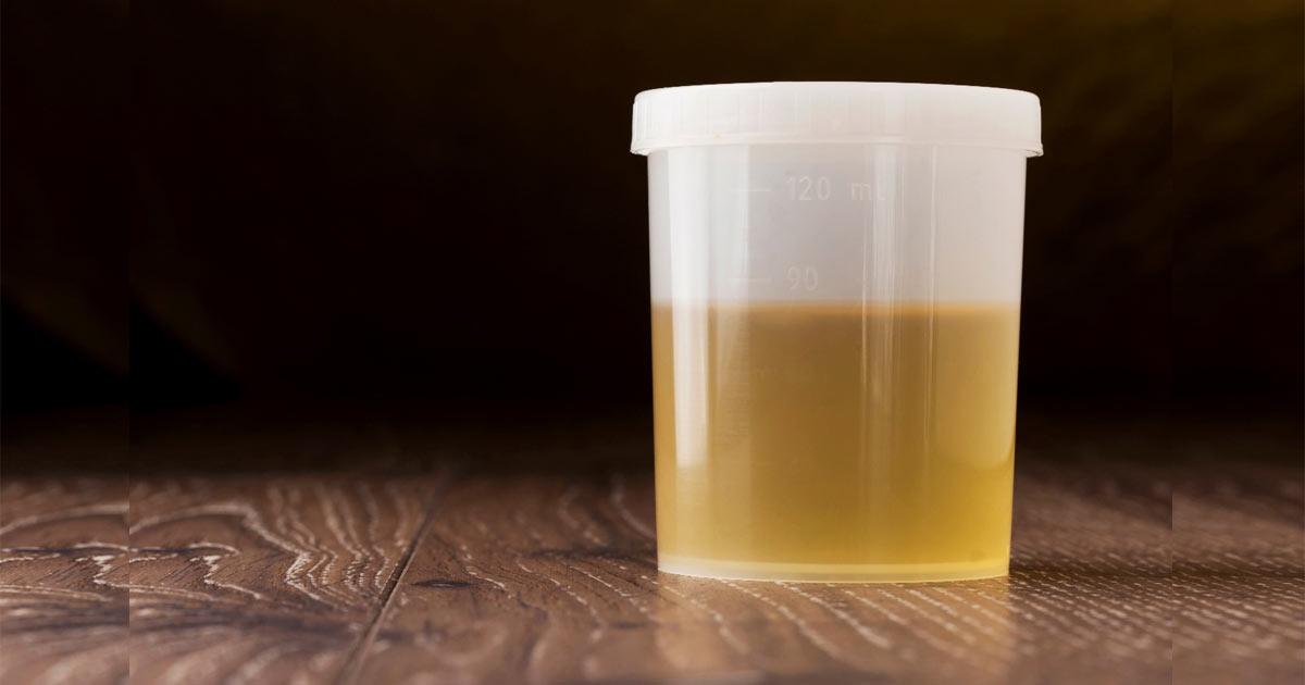 Ancient Romans Brushed Their Teeth with Urine | Ancient Origins