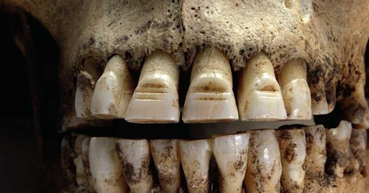 Did These Filed and Grooved Teeth Belong to a Viking Elite Warrior ...