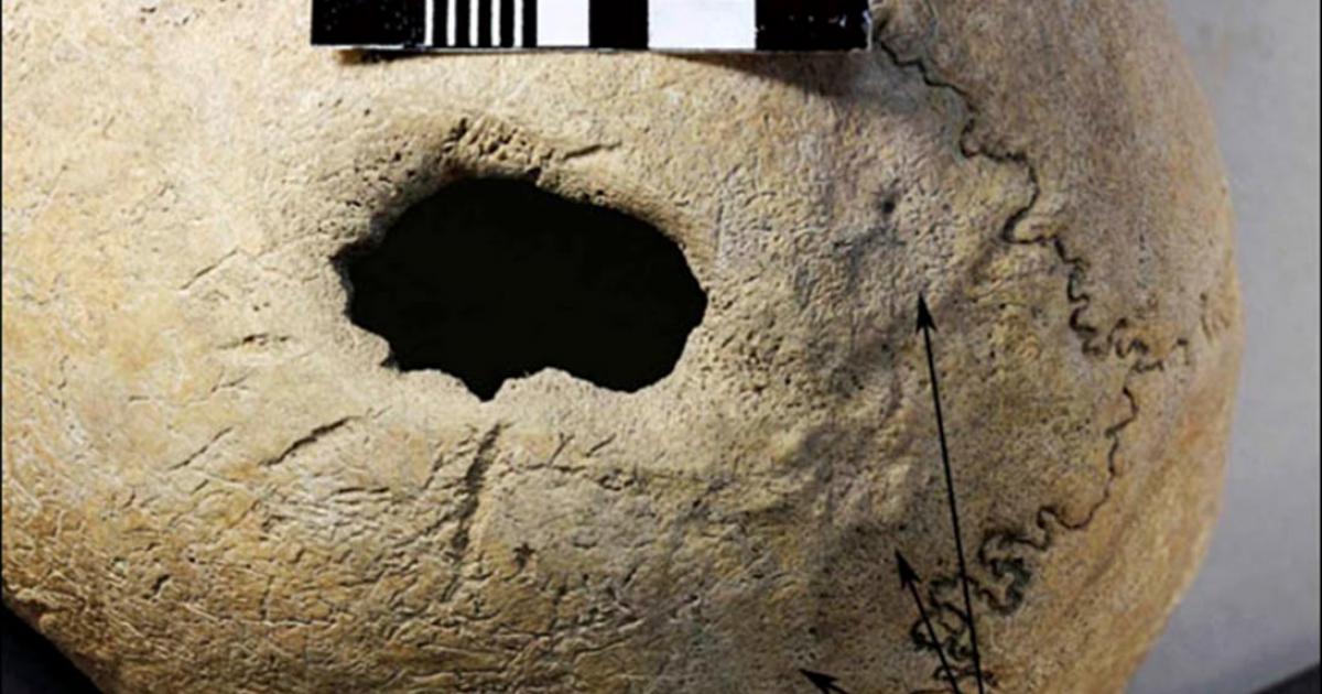 Reconstructing Brain Surgery as It Was Conducted Around 3,000 Years Ago ...