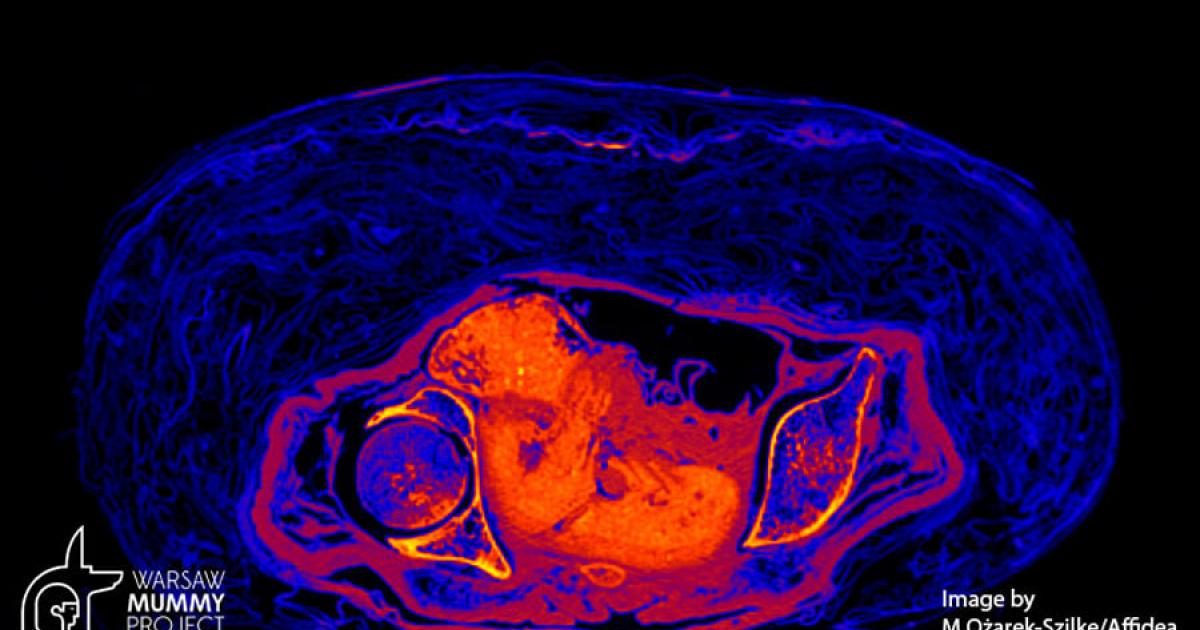 Fetus Found Mummified Inside the Womb of a 2,000-Year-Old Egyptian ...