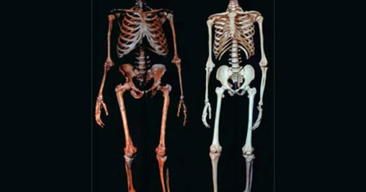 Neanderthal Skeleton Comparison What Is The Evidence For Human
