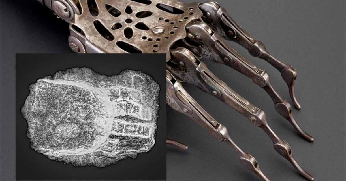 Archaeologists Unearth a Medieval Skeleton with a Prosthetic Hand ...