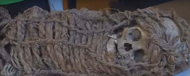 Peruvian Mummy Taken to Children’s Hospital for Revealing X-rays ...