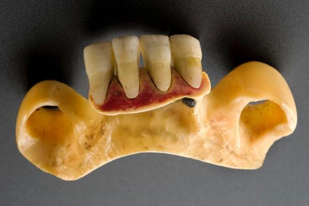 Waterloo Teeth: Wearing A Dead Man’s Grin | Ancient Origins