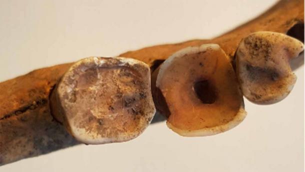 Viking Age Dental Care Was Surprisingly Good, Says Study | Ancient Origins