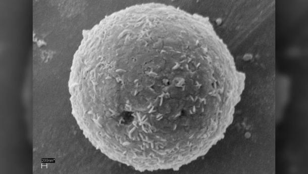 Neolithic Fisherman Died by Drowning 5,000 Years Ago, New Research ...