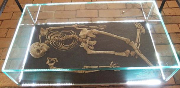 Deformed Medieval Man Found Broken By the Wheel of Torture | Ancient ...