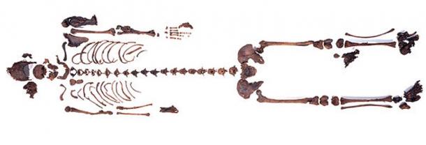 The Moora Mystery: What Happened When a Girl Stepped into the Moor ...