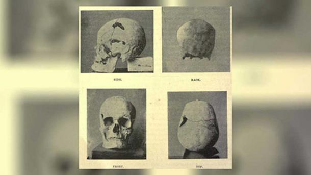 The Giants of Ancient Egypt: Part II – Physical Evidence of the Giant ...