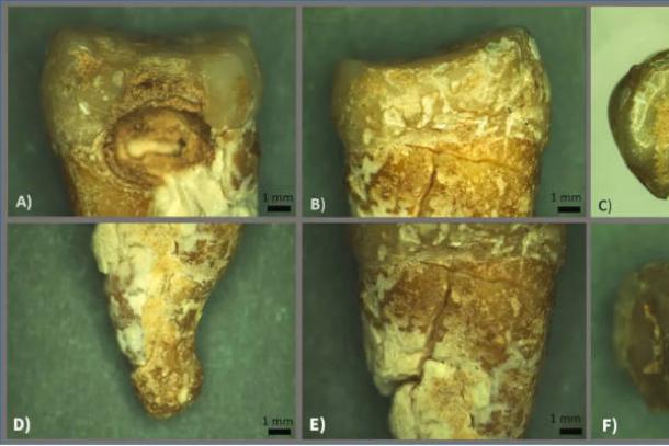 5th Century Byzantine Monk Buried in Chains in Jerusalem Was a Woman ...