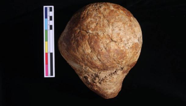 Seven-Pound Calcified Uterus Unearthed in British Cemetery | Ancient ...