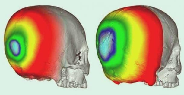 Japan’s Hirota People Were Reshaping Infants’ Heads 1,500 Years Ago | Ancient Origins