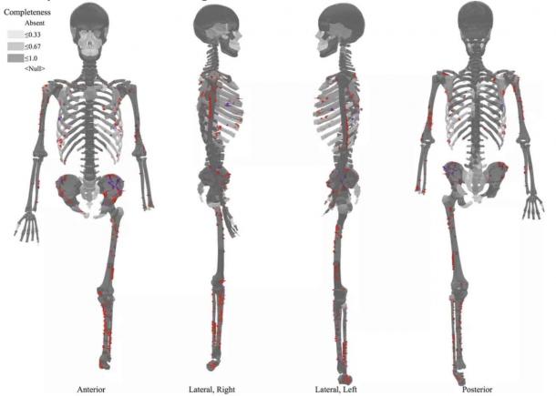 Oldest Shark Attack Victim Ever, Found in an Ancient Japanese Mound ...