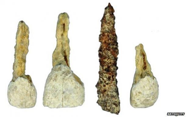 Archaeologists discover 2,300-year-old dental implant in Iron Age ...