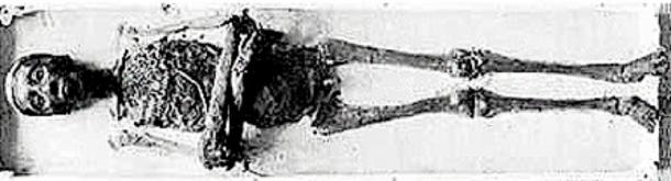 The Mystery of King Tut’s Death Finally Solved? | Ancient Origins