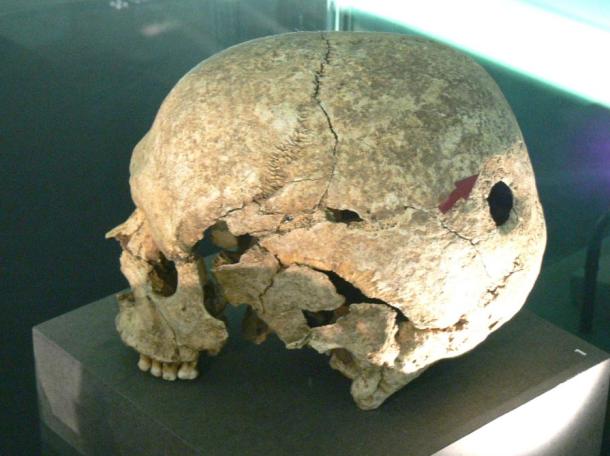 Medieval Woman Gave Birth AFTER Her Death | Ancient Origins