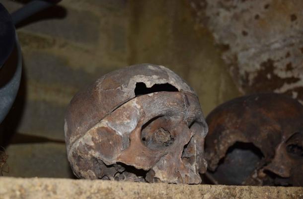 Medieval Skull Found Beneath Rothwell Church Shows Violent Blow ...