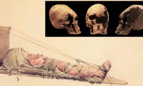 cranial deformation | Ancient Origins