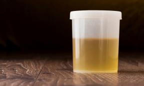 Medieval Physicians Used to Taste Patients’ Urine for Diagnosing ...