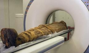 heart disease | Ancient Origins